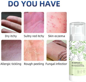 Eczemaron Ringworm Malam For Anti Dad Khaj Khujli, Skin fungal ...