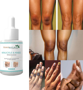 7days natural Dark Knuckles knee Whitening Serum For Removing Dark ...
