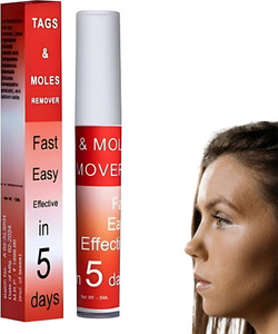 Hukkyo Skin tag remover fast safe wart mole solution for easy skin care ...