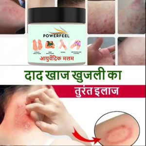 POWERFEEL Ayurvedic ItchCoat Anti fungal Malam - for Ringworm, itching ...