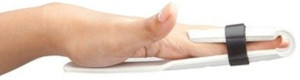 IGR Finger extension splint with velcro Supporter - Buy IGR Finger ...