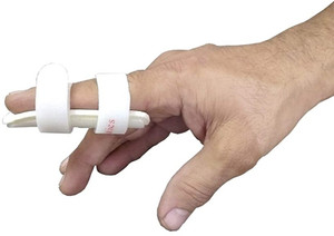 Salo Orthotics Progressive Finger Extension Splint, Rigid Splinting ...