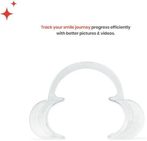 Toothsi Premium Cheek / Lip Retractor C-Shape Mouth Opener Size Large ...