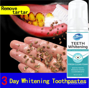 Latibule Teeth Whitening Foam to Ultra-fine Deeply Clean Gums Stain ...