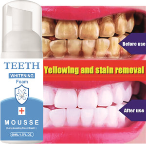 Latibule Teeth Whitening Liquid For Clean Teeth and Mouthwash dental ...