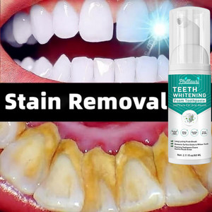 Phillauri Teeth Whitening Mousse Foam To Deeply Cleaning Gums, Stain ...
