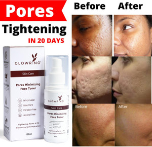 Glowrino cares Pores minimizing face toner for open pores skin Men ...