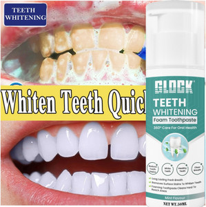 Glock Teeth Whitening Mousse Foam To Deeply Cleaning Gums, Stain ...